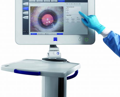 CALLISTO EYE — Asta Tec